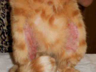 Eosinophilic Pustular Dermatitis